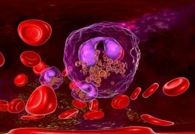 Eosinofilia. Revisión de la biología de los eosinófilos y las ...