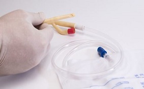 Infecciones del tracto urinario asociadas a catéteres - Infomed Santiago